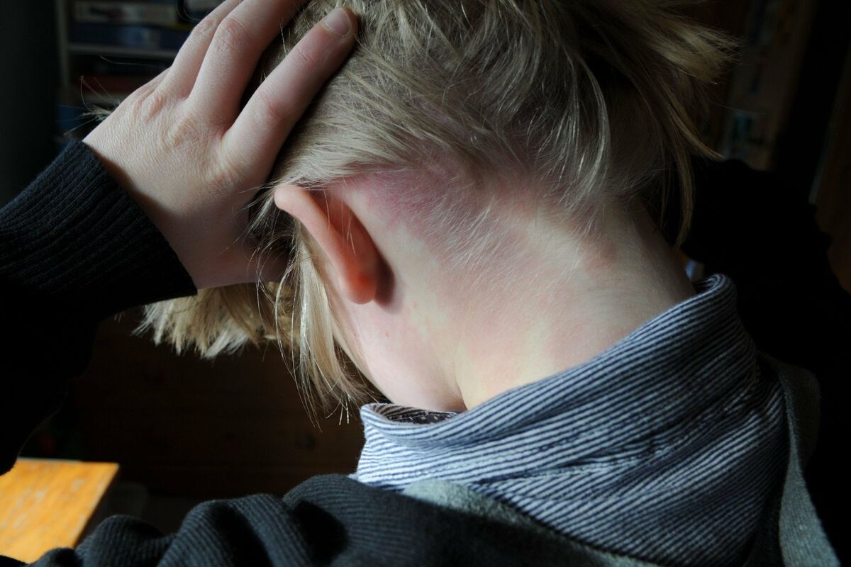 Šta ako vam iz mladeža raste dlaka