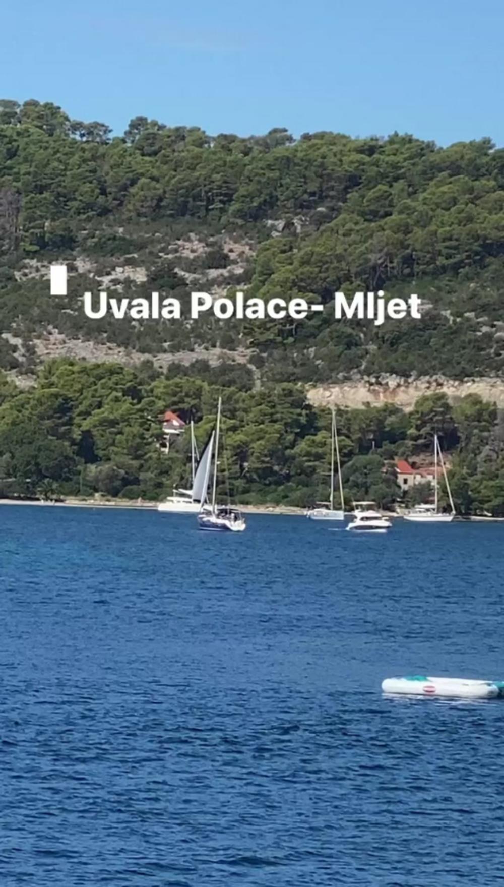 LEPA BRENA SA JAHTE STIGLA NA MESTO GDE JE POLOMILA OBE RUKE! Skinula sve sa sebe i pokazala ...