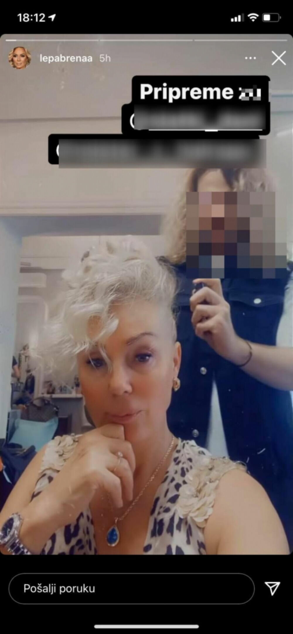 LEPA BRENA NAPRAVILA PROMENU GODINE: Sa strane NEMA KOSU, a gore digla veliku ĆUBU! (FOTO)