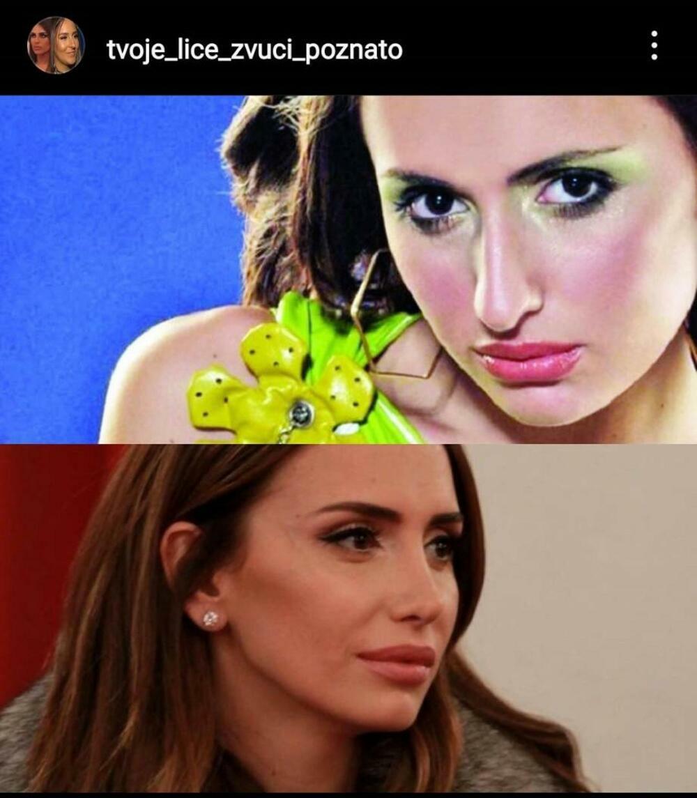 Emina Jahović pre operacija