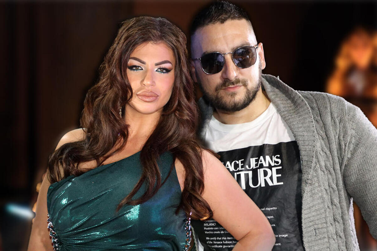 Miljana Kulić optužila Zolu da joj je napravio modricu