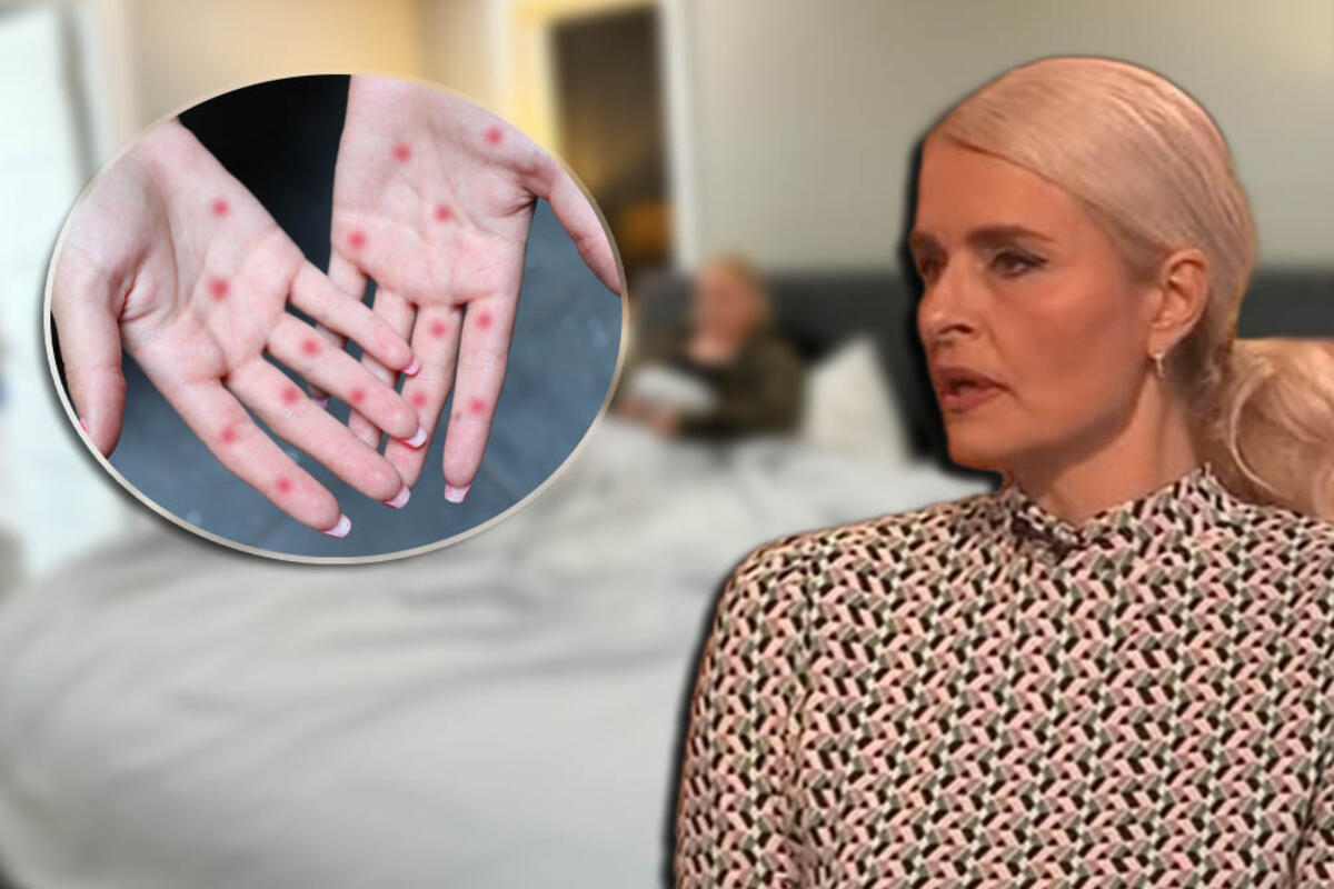 Najčešći simptomi stomačnog virusa tokom vrućina