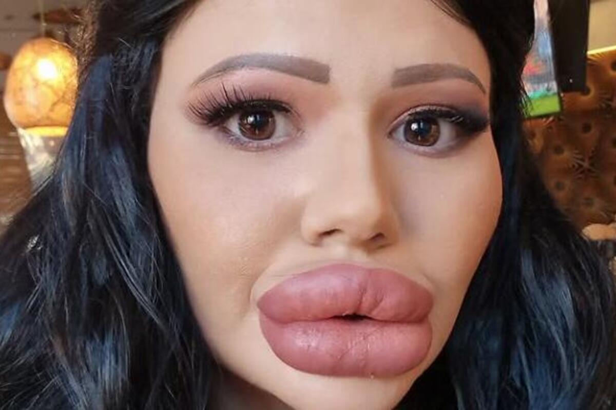 Andrea Ivanova ima najveće usne - samo što ne puknu